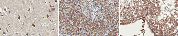 Anti-TERT Antibody | ABE2075